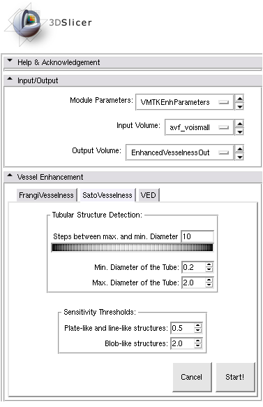 vmtk - the Vascular Modeling Toolkit | Main / VmtkIn3DSlicer