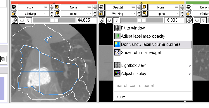 Modules:Editor-Documentation - Slicer Wiki