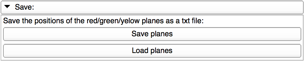 Documentation/4.5/Extensions/AnglePlanes - Slicer Wiki