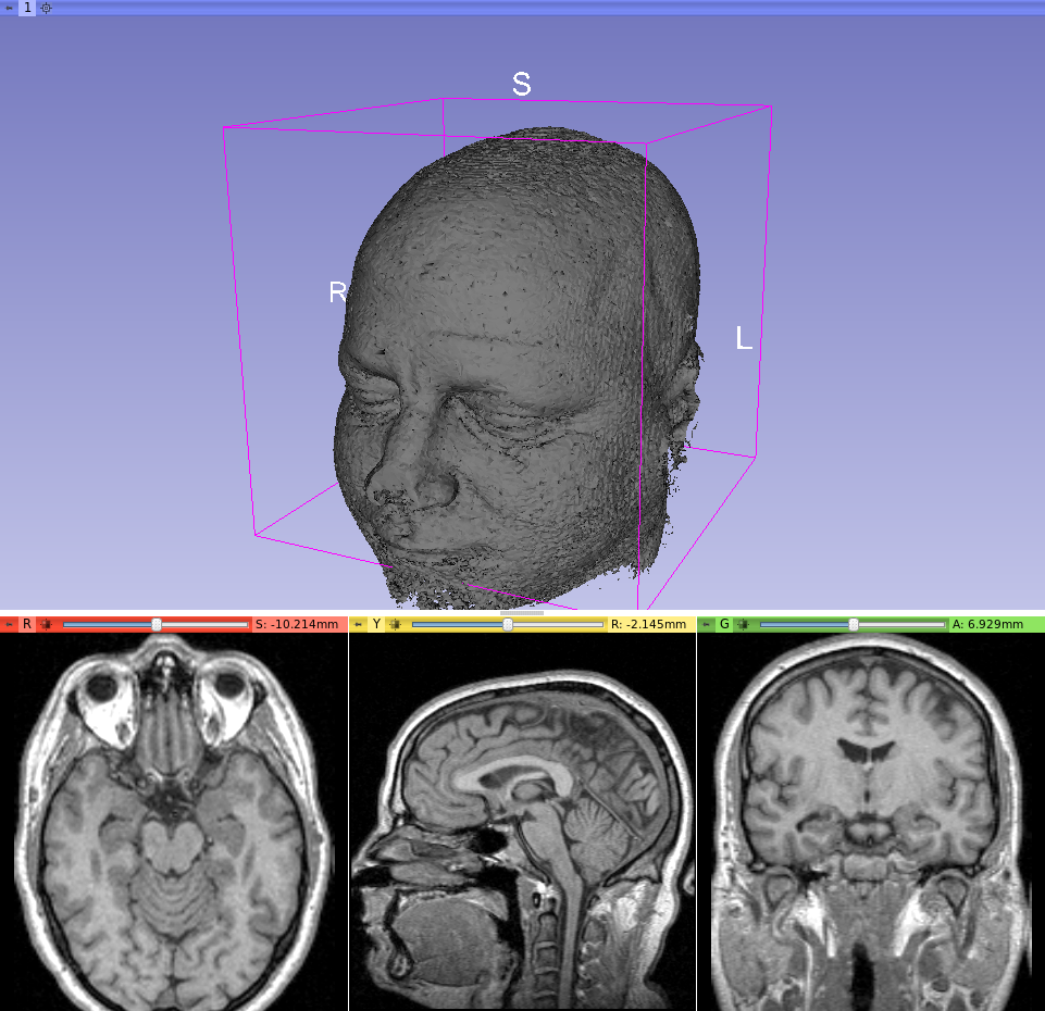 Documentationnightlymodulessurfacetoolbox Slicer Wiki