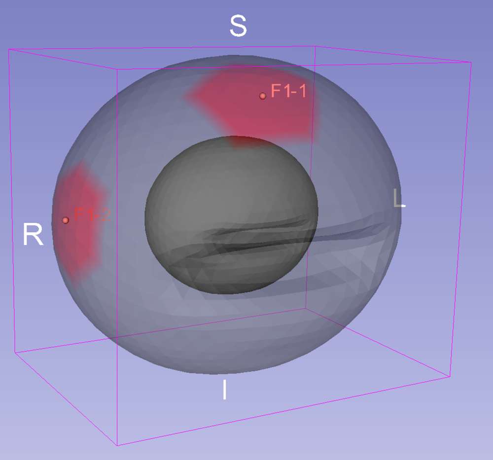 Documentation/4.6/Extensions/PickAndPaint - Slicer Wiki