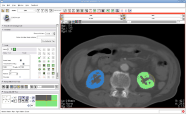 Announcements:Slicer3.2 - Slicer Wiki