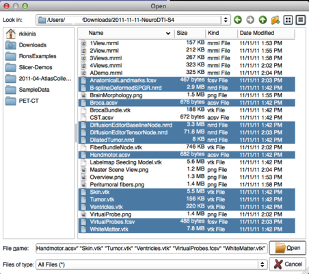 Documentation/4.10/SlicerApplication/LoadingData - Slicer Wiki