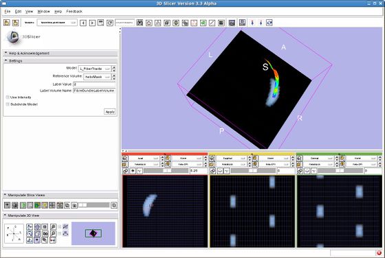 Modules:Model Into Label Volume Documentation-3.6 - Slicer Wiki