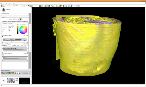 Modules:VolumeRendering-Documentation-3.6 - Slicer Wiki