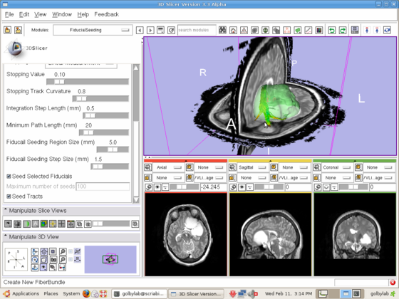 Modules:NeuroNav-Documentation-3.6 - Slicer Wiki