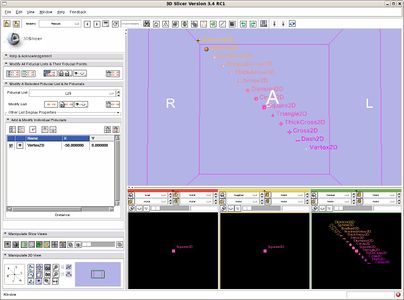 Announcements:Slicer3.6 - Slicer Wiki
