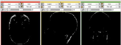 Modules:ThresholdImage-Documentation-3.6 - Slicer Wiki