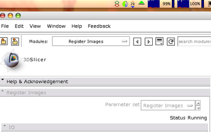 Modules:RegisterImages-Documentation-3.6 - Slicer Wiki