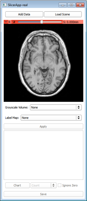 Documentation/4.10/Developers/Slicelets - Slicer Wiki