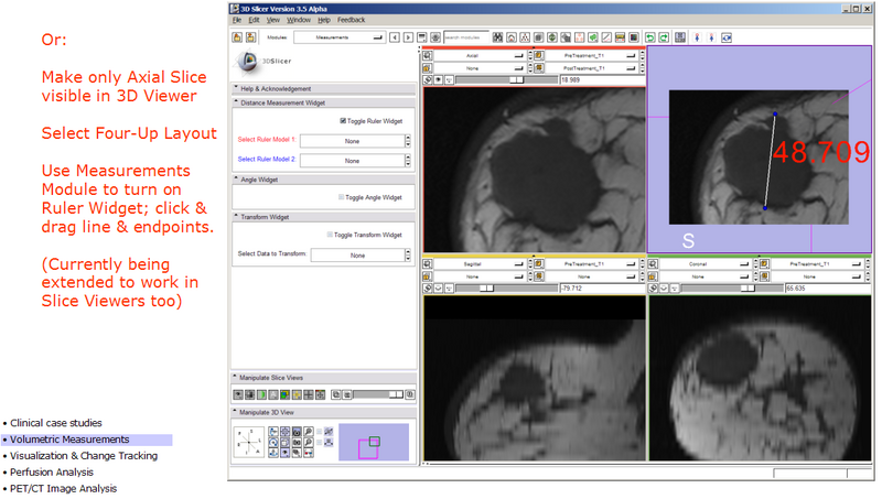 Slicer3:UIDesign:WorkingProblems:BCAnalysis:Volumetric - Slicer Wiki