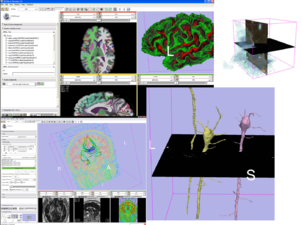 Announcements:Slicer3.2 - Slicer Wiki