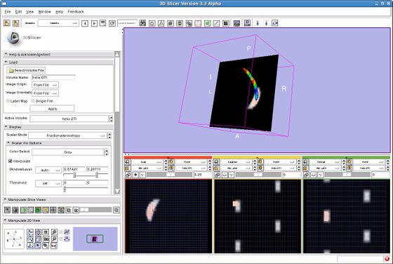 Modules:Model Into Label Volume Documentation-3.6 - Slicer Wiki