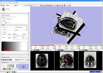 Slicer3:VisualBlog - Slicer Wiki