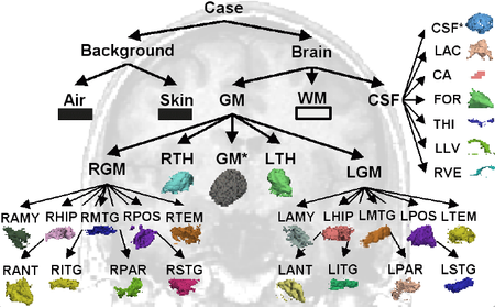 Documentation/4.10/Modules/EMSegmenter - Slicer Wiki