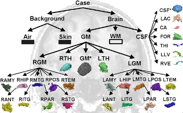 Documentation/Nightly/Modules/EMSegment - Slicer Wiki
