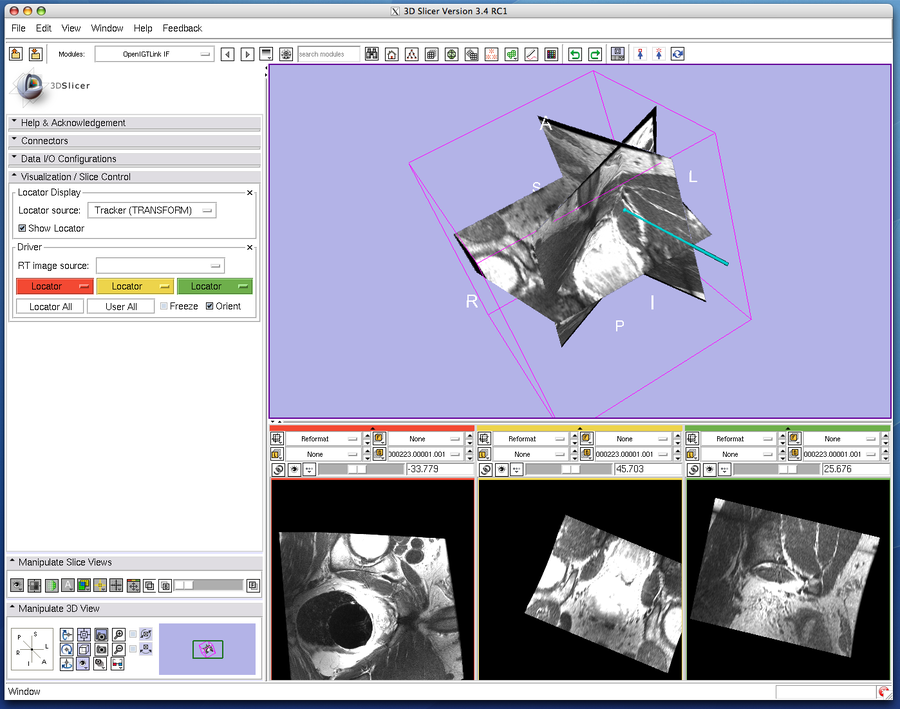 Modules:OpenIGTLinkIF-Documentation-3.4 - Slicer Wiki