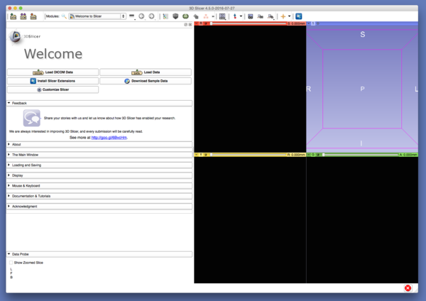 Documentation/4.8/Extensions/CurveMaker - Slicer Wiki