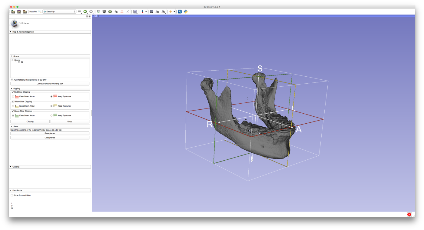 Documentation/Nightly/Modules/EasyClip - Slicer Wiki