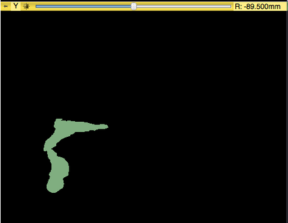 Documentation/Nightly/Modules/LabelAddition - Slicer Wiki