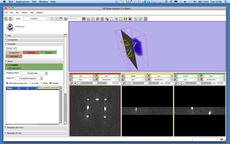 Modules:ProstateNav-Documentation-3.6 - Slicer Wiki