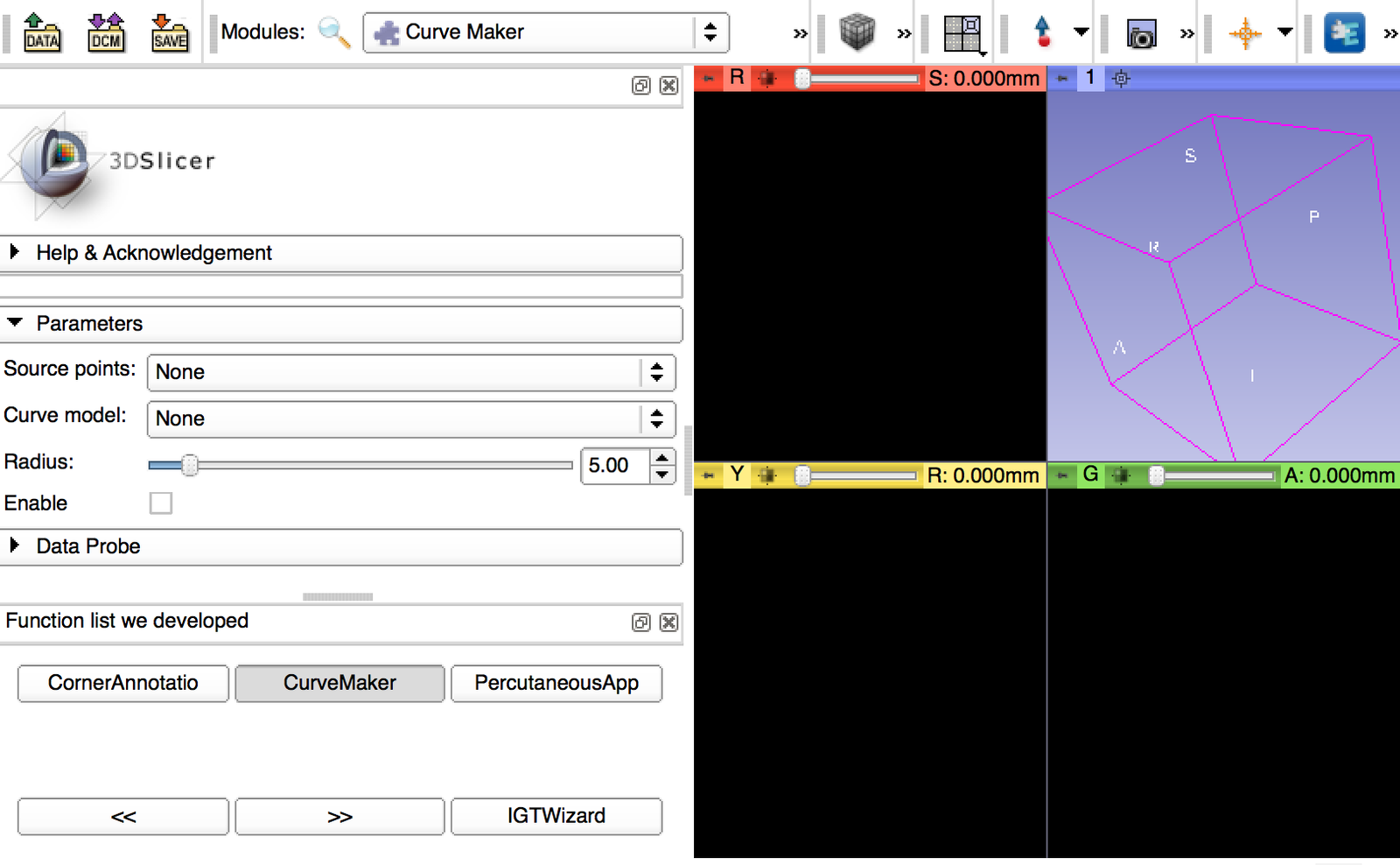 Documentation/4.10/Extensions/IGTWizard - Slicer Wiki