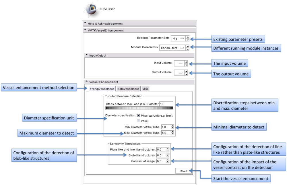 Modules:VMTKVesselEnhancement - Slicer Wiki