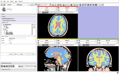 Slicer3:VisualBlog - Slicer Wiki