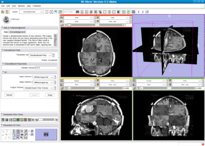 Modules:CheckerBoard-Documentation-3.4 - Slicer Wiki