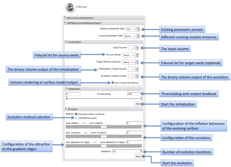 Modules:VMTKEasyLevelSetSegmentation - Slicer Wiki
