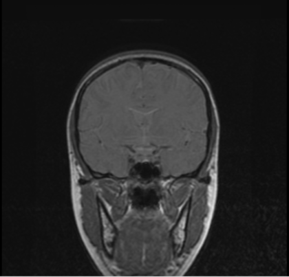 Documentation/4.10/Modules/BRAINSMush - Slicer Wiki