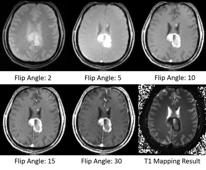 Documentation/Nightly/Modules/T1Mapping - Slicer Wiki