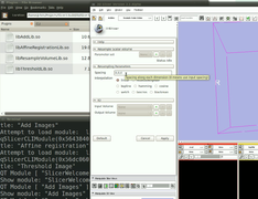 Slicer3:VisualBlog - Slicer Wiki