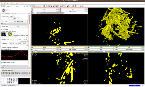 Modules:VolumeRendering-Documentation-3.6 - Slicer Wiki