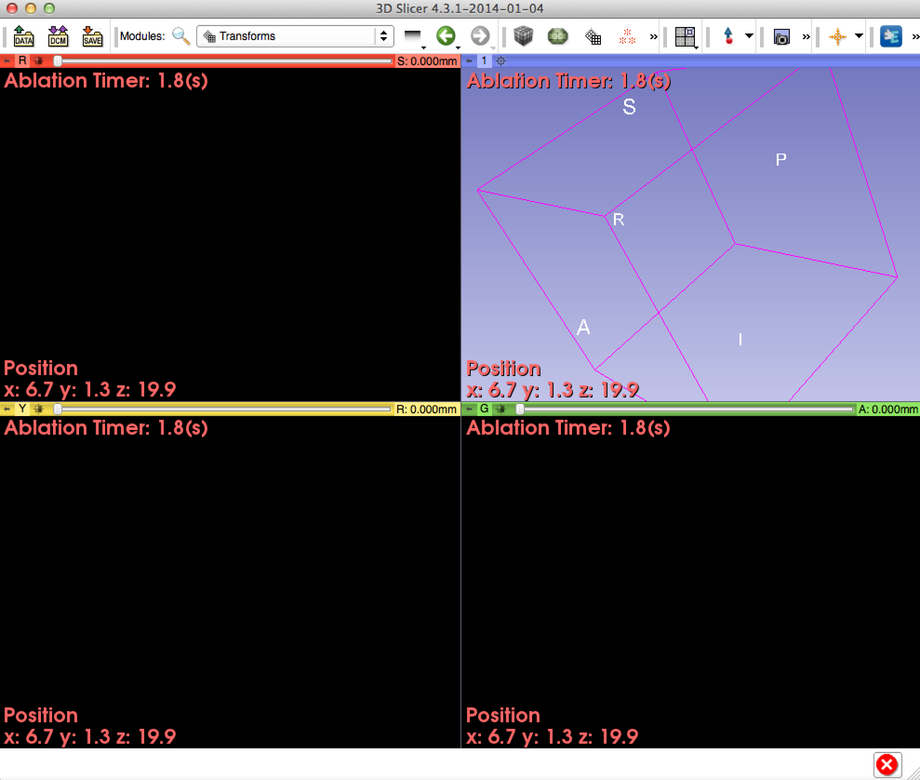 Documentation/4.4/Modules/CornerAnnotation - Slicer Wiki