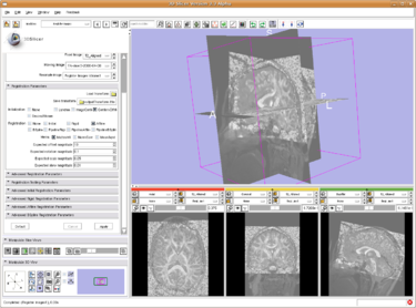 Slicer3:LinearRegistrationUseCases - Slicer Wiki