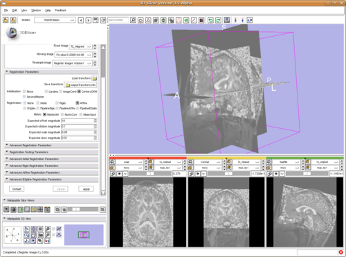 Slicer3:LinearRegistrationUseCases - Slicer Wiki