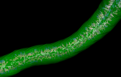Modules:VMTK in 3D Slicer Tutorial: Coronary Artery Centerline Extraction - Slicer Wiki