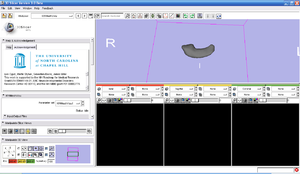 Slicer3:VisualBlog - Slicer Wiki