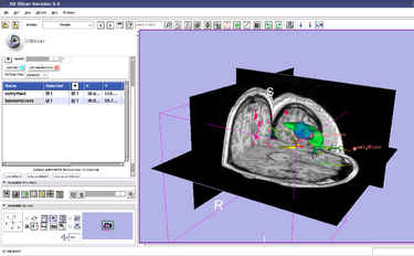 Slicer3.4:Training - Slicer Wiki