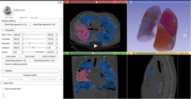 Documentation/4.10/Training - Slicer Wiki
