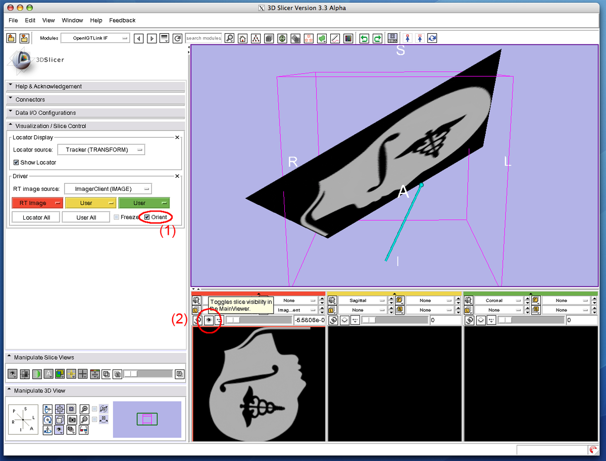 Modules:OpenIGTLinkIF-Documentation-3.6 - Slicer Wiki