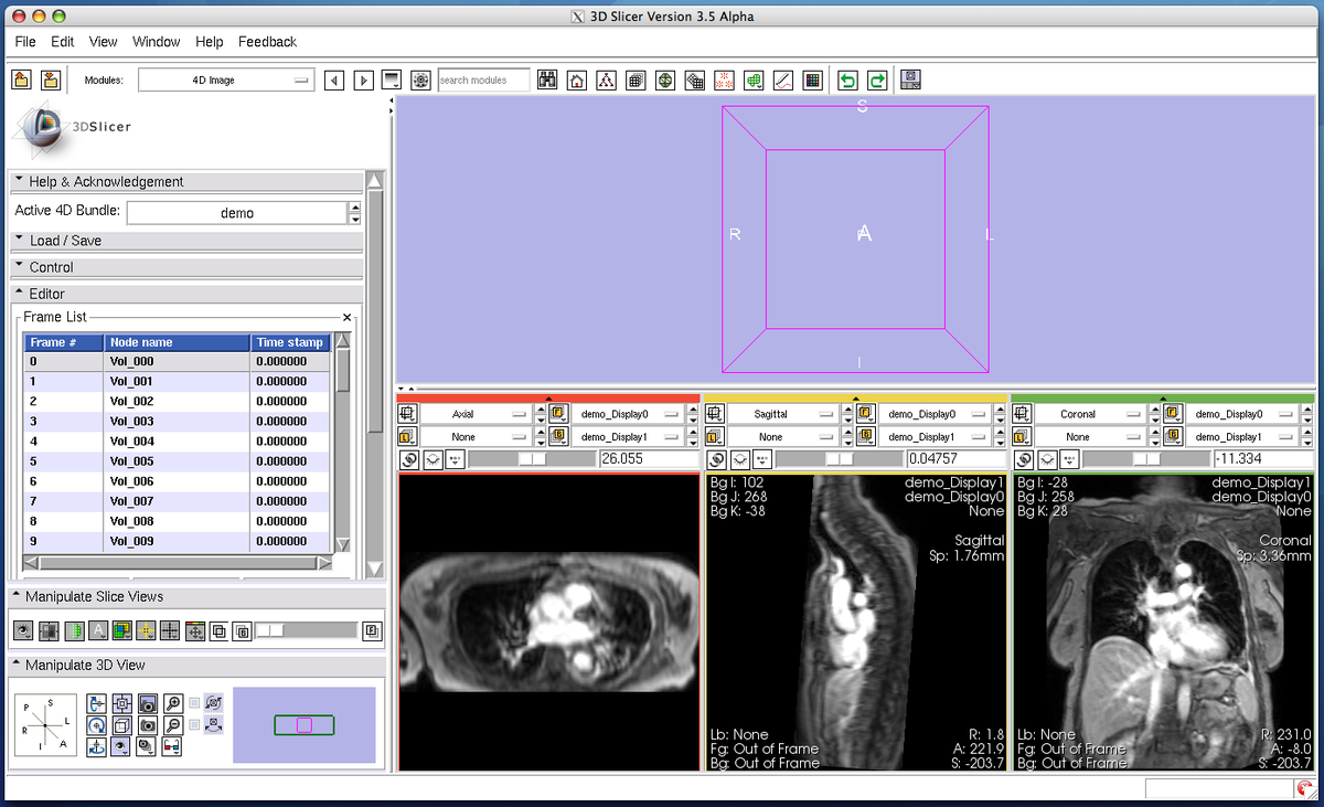 Modules:FourDImage-Documentation-3.6 - Slicer Wiki