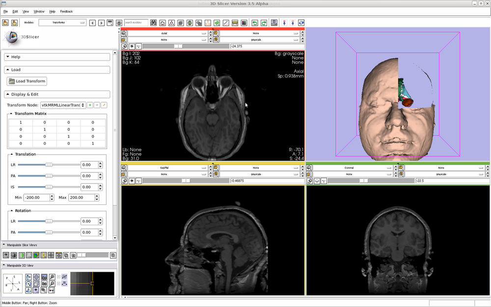 Documentation/Nightly/Developers/ImageGallery - Slicer Wiki