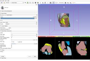 Documentation/4.1/Modules/ModelMaker - Slicer Wiki