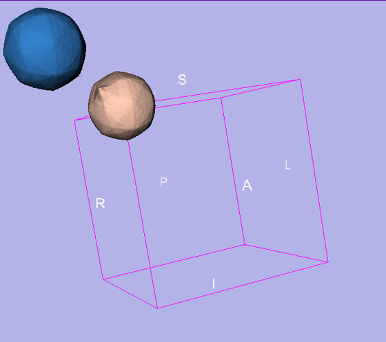 Slicer3:Module:BinaryErodeOperations-Documentation-3.2 - Slicer Wiki