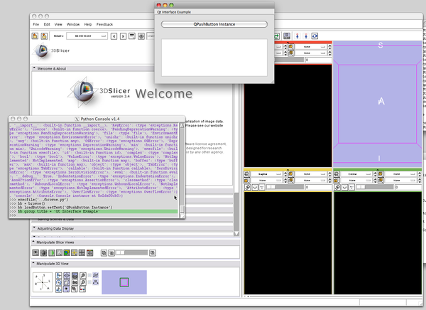 Qt in Slicer3 - Slicer Wiki
