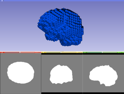 Documentation/4.5/Modules/BodyCentricCubicMesh - Slicer Wiki