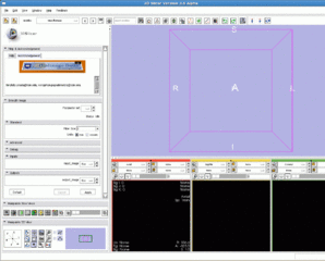 Slicer3:VisualBlog - Slicer Wiki