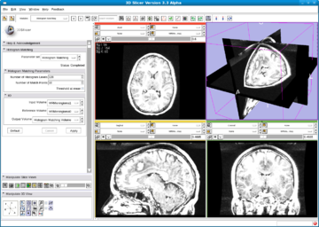 Modules:HistogramMatching-Documentation-3.6 - Slicer Wiki
